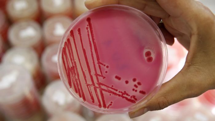 BIOLAB AS DI UKRAINA BIKIN BIOWEAPON DENGAN REKAYASA GENETIKA ...